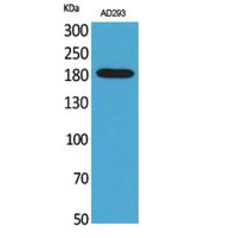 Anti Macroglobulin α 2 Antibody A40865