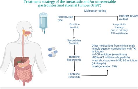 Treatment Of Advanced Gastrointestinal Stromal Tumors Gist Pdgfra Download Scientific