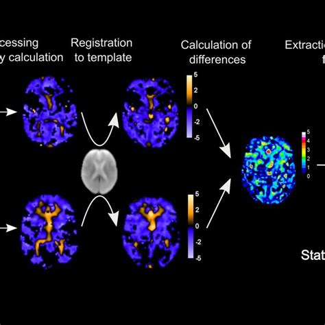 Processing Pipeline Of The Resting‐state Functional Mri Rsfmri Data Download Scientific