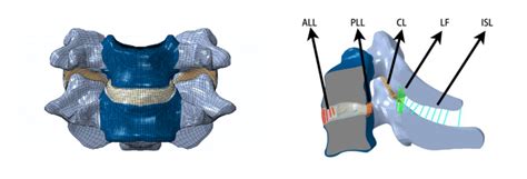 The Cervical Fe Model Of C5 C6 Cervical Spine Including Vertebra