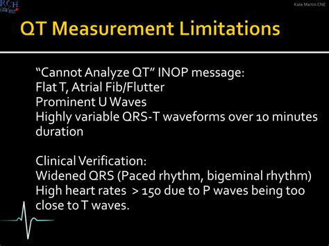 Ppt Beyond Arrhythmias St Qt Segment Monitoring Powerpoint Presentation Id