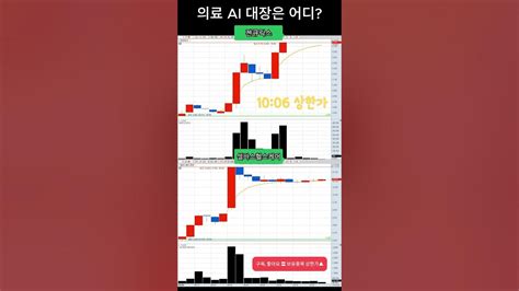 9월 6일 의료ai 대장주는 차트멍 특징주 상한가 급등주 주식 차트 세력주 의료장비 의료ai 셀바스헬스케어 라이프시맨틱스 클리노믹스 젠큐릭스
