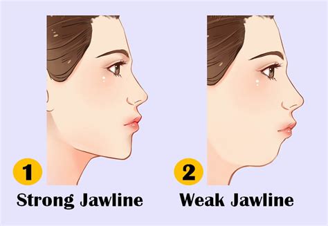 Chiseled Jawline Sussex Beauty Clinic