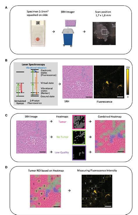 Figure 1 From Intraoperative Microscopic Autofluorescence Detection And Characterization In
