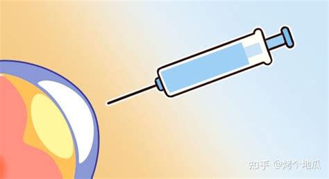 糖尿病性黄斑水肿的治疗方法有哪些？ 知乎