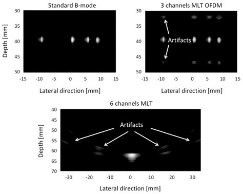 Practical Guide To Ultrasound Beam Forming Beam Pattern And Image Reconstruction Analysis