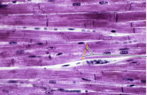 solved identify the highlighted structure