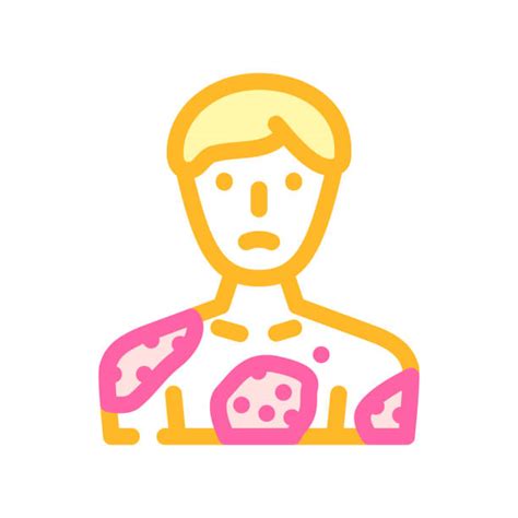 70 Ichthyosis Skin Stock Illustrations Royalty Free Vector Graphics