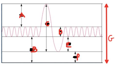 16 R1 Interpretation Of Lung Function Incomplete Need To Add Flow
