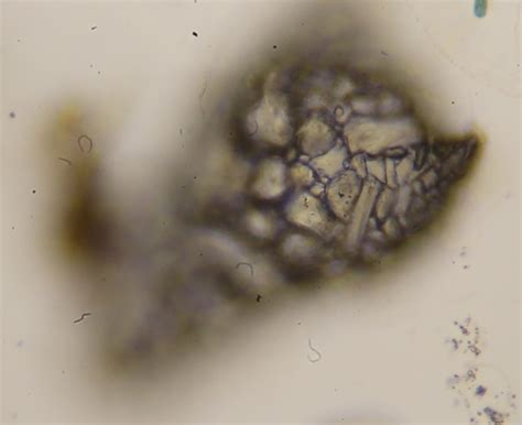 Difflugia Nodosa Protozoans Of The Usa · Inaturalist