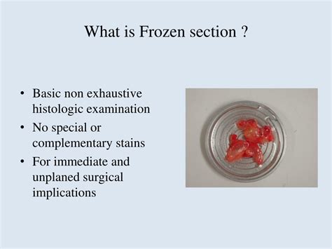 Ppt Frozen Section Powerpoint Presentation Free Download Id 8970336