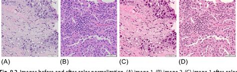 Figure 82 From Deep Learning Based Nuclei Segmentation And