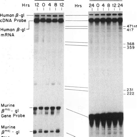 Si Nuclease Transcript Mapping To Quantitate Human 1 Globin And Murine Download Scientific