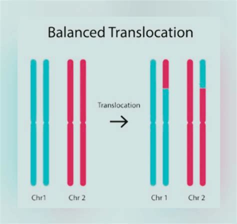 Balanced Translocation