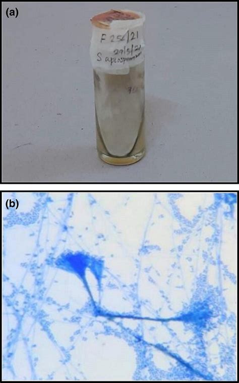 A B Colony Morphology And Lpcb Tease Mount Preparation Magnification
