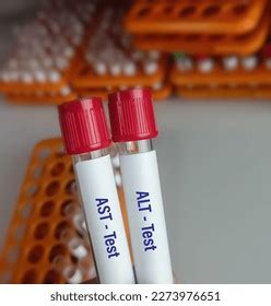 Ast Images Stock Photos Vectors Shutterstock