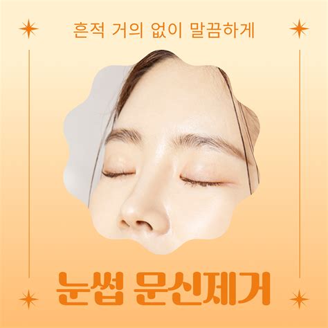 눈썹 문신제거 할인 가격 후기 전후 효과 정보 By 메디코스의원 여신티켓 국내 1등 피부과 성형외과 플랫폼