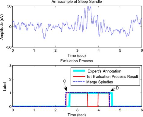Figure 2 From Sleep Spindle Detection In Sleep Eeg Signal Using Sparse