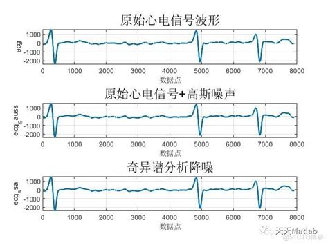 【心电信号】基于svd实现心电信号奇异谱分析降噪附matlab代码 Csdn博客