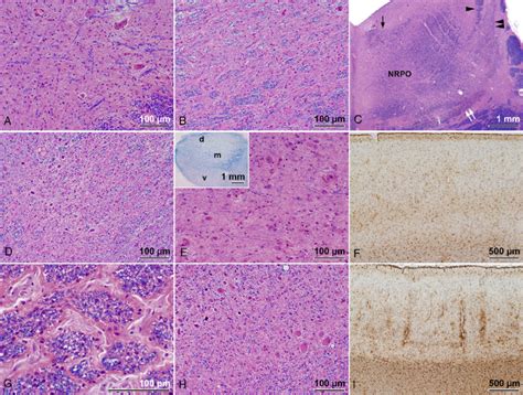Microscopic Findings Of Oculomotor Auditory And Visual Pathways In Download Scientific