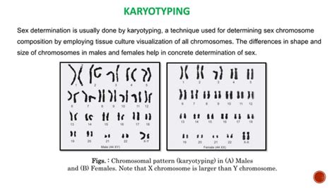 Sex Differentiation And Development Pptx Reproductive Health Diseases And Conditions