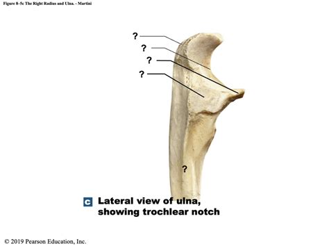 Lateral View Of Ulna Showing Trochlear Notch Diagram Quizlet