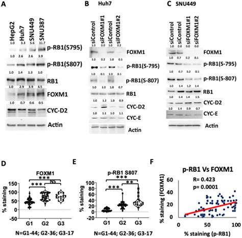 Hepatocellular Carcinoma Evades Rb1 Induced Senescence By Activating
