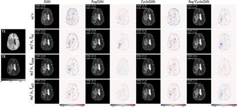 Figure 4 From Freggan With K Space Loss Regularization For Medical Image Translation Semantic