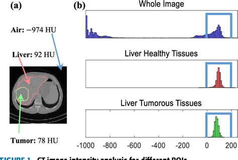 Figure 1 From Deep Learning Initialized And Gradient Enhanced Level Set Based Segmentation For