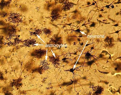 Astrocyte Histology