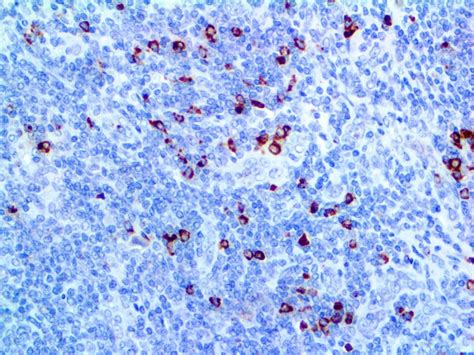 Granzyme B Rmab Bio Sb