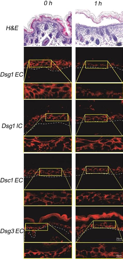 Exfoliative Toxin E A New Staphylococcus Aureus Virulence Factor With