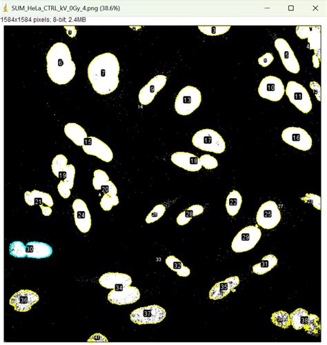 Automating Imagej Color Thresholder User Input Using A Macrojavapython Image Analysis