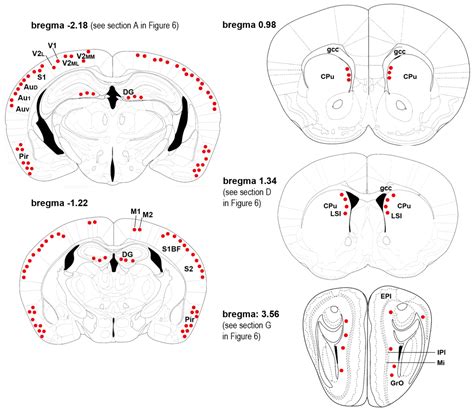 Rhinal Cortex Sectioned View Rhinal Cortex Sectioned View