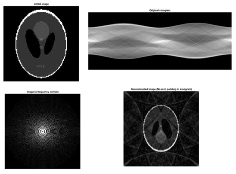 Image Processing Implementing A Filtered Backprojection Algorithm