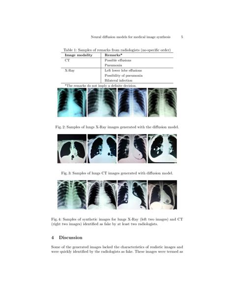 Spot The Fake Lungs Generating Synthetic Medical Images Using Neural Diffusion Models Deepai