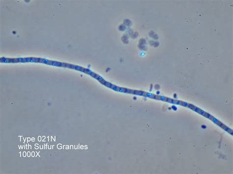 Filamentous Bacteria Gallery 4g Environmental Corporation