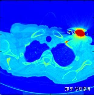 处理医疗影像的Python利器PyDicom 知乎