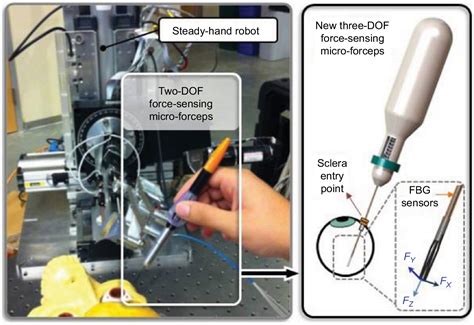 Robot Assisted Vitreoretinal Surgery Current Perspectives Rsrr