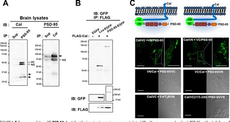 Figure 1 From Dopamine Receptor Internalization Psd 95 Protein And
