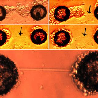 The dynamic of a network self organization process on 100 µm patterned