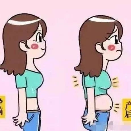 科普产后腹直肌分离要重视 运动 肌肉 治疗