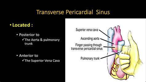 Transverse Sinus Heart