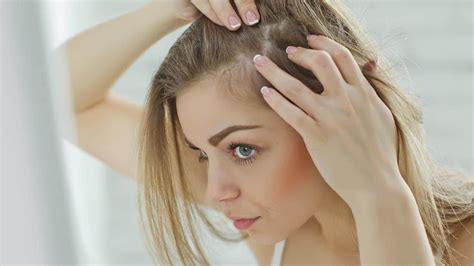 What Is Scalp Acne Its Causes Types And Prevention
