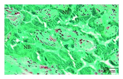 Bone Regeneration In A Rabbit Critical Size Mandibular Defect Model Download Scientific Diagram