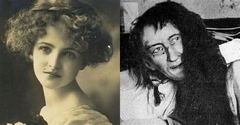 Blanche Monnier The Woman Who Was Locked In An Attic