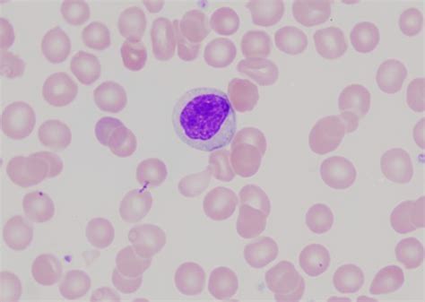 Hematology 2 All Cell Morphologies Flashcards Quizlet