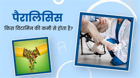 पैरालिसिस किस विटामिन की कमी से होता है Which Vitamin Deficiency Linked With Paralysis In