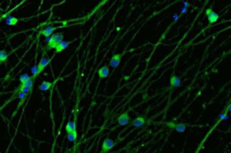 Ipsc Reprogramming For Disease Cell Modeling Charles River