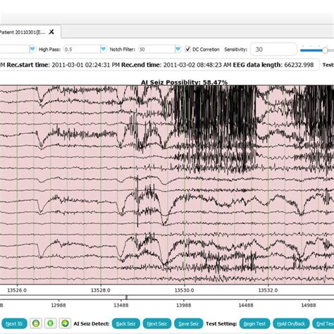 Our User Interface UI Used In Clinical Tests Download Scientific Diagram